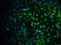 SCp2 Mouse Mammary Epithelial Cell Line | SCC458
